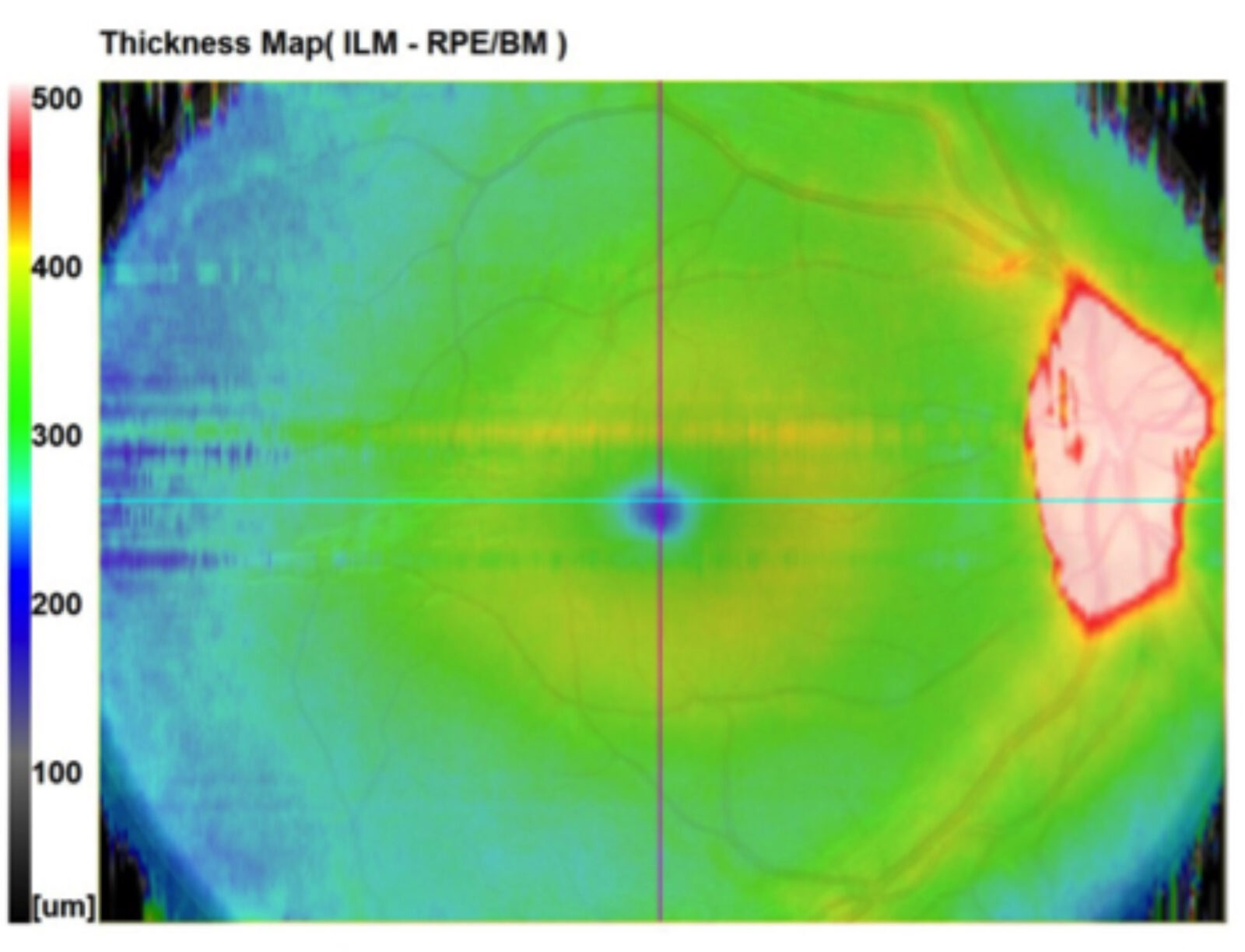 Optometry e-learning | Earn your CET points | Viewpoint