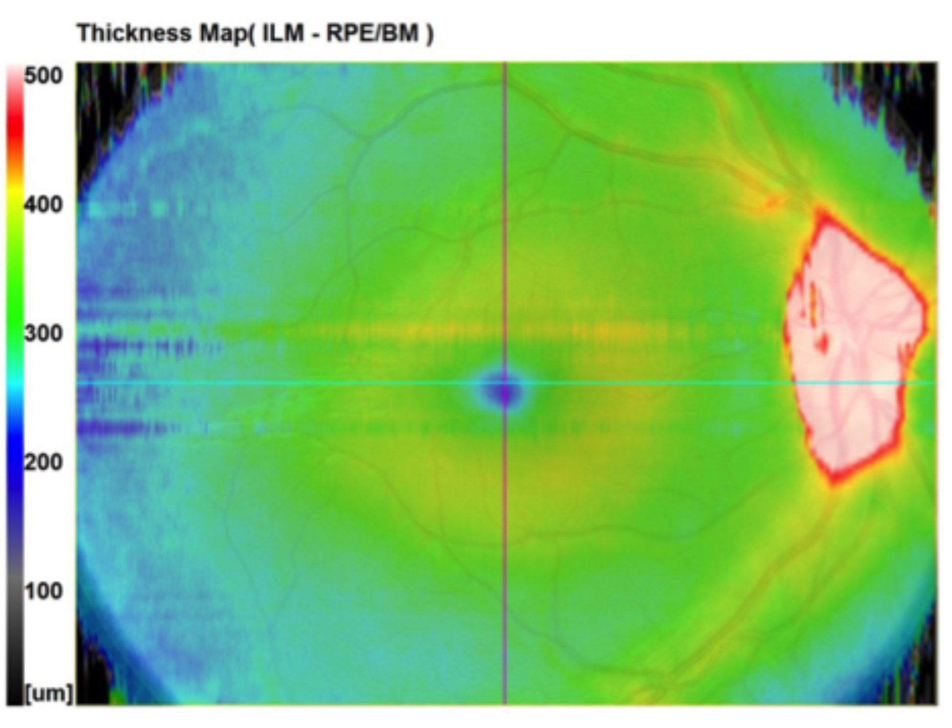 OCT and medical retina: case studies | Viewpoint