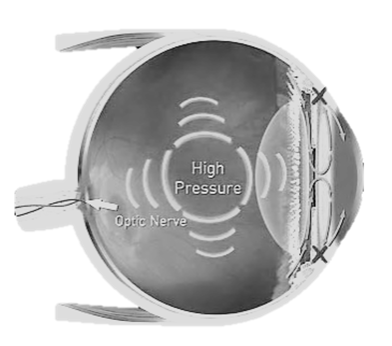 Optometry Atlas: Optic nerve conditions | Viewpoint