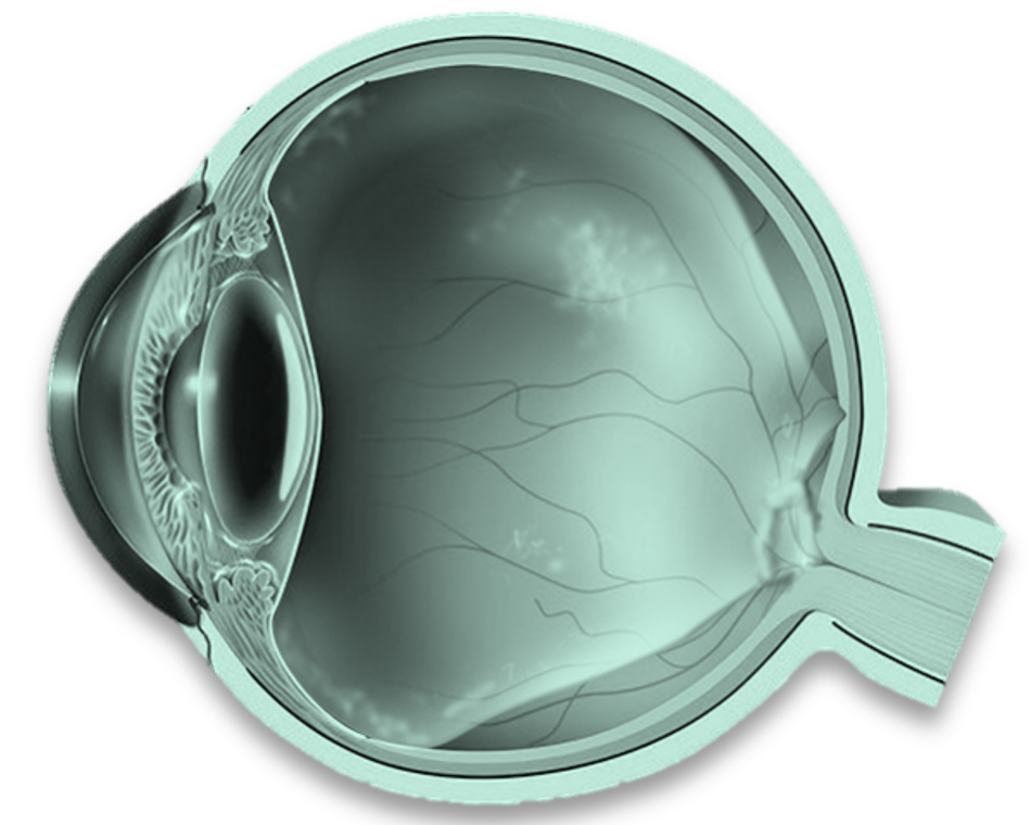 Optometry Atlas: Vitreous | Viewpoint