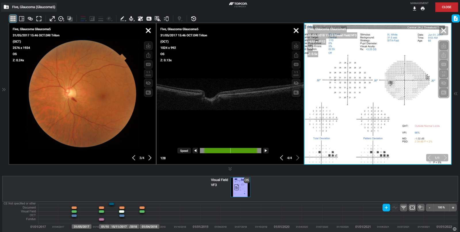 How to optimise glaucoma detection in practice | Viewpoint
