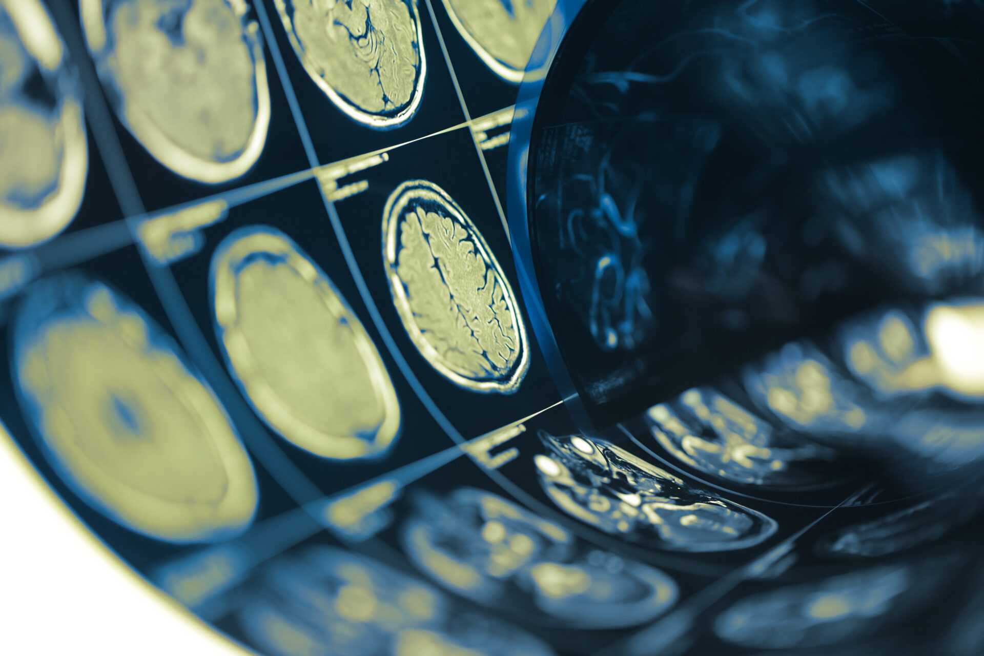 Clinical guidelines about concussions and vision | Viewpoint