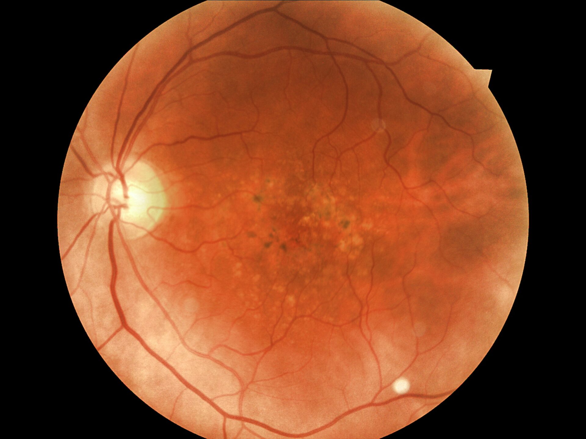 Optometry discussions | Eye care topics | Viewpoint