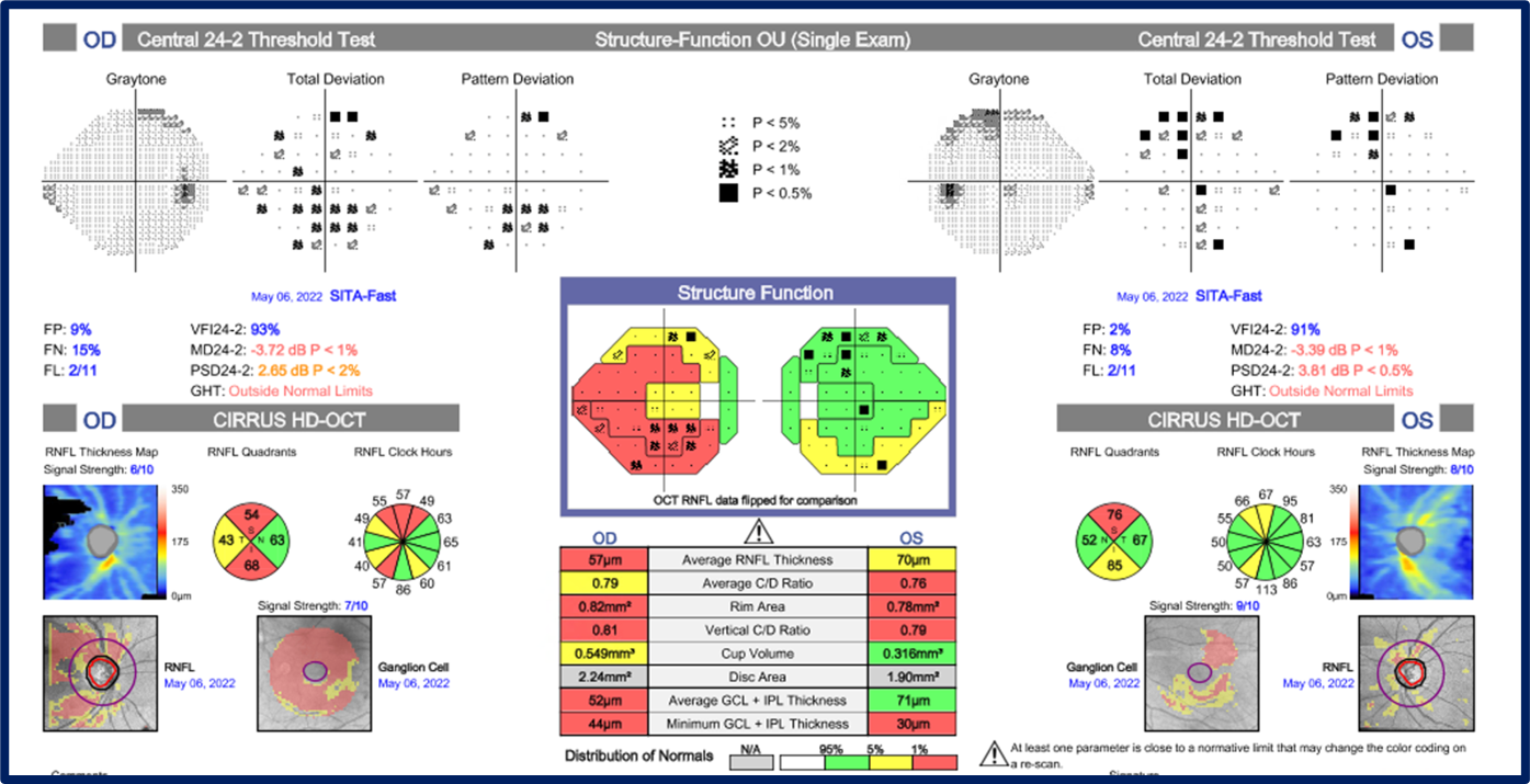 Primary and secondary open-angle glaucoma | Viewpoint