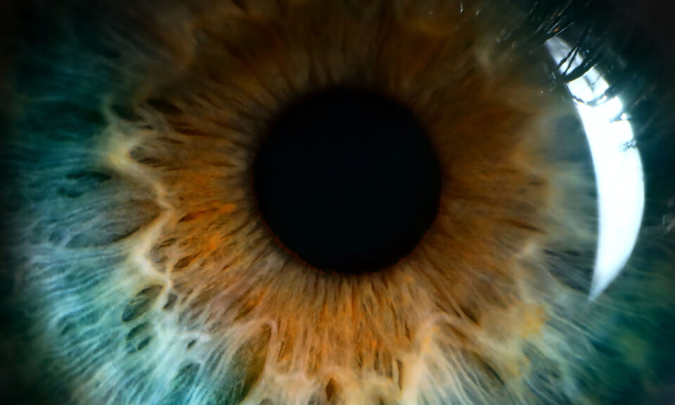 Posterior uveitis and panuveitis | Viewpoint