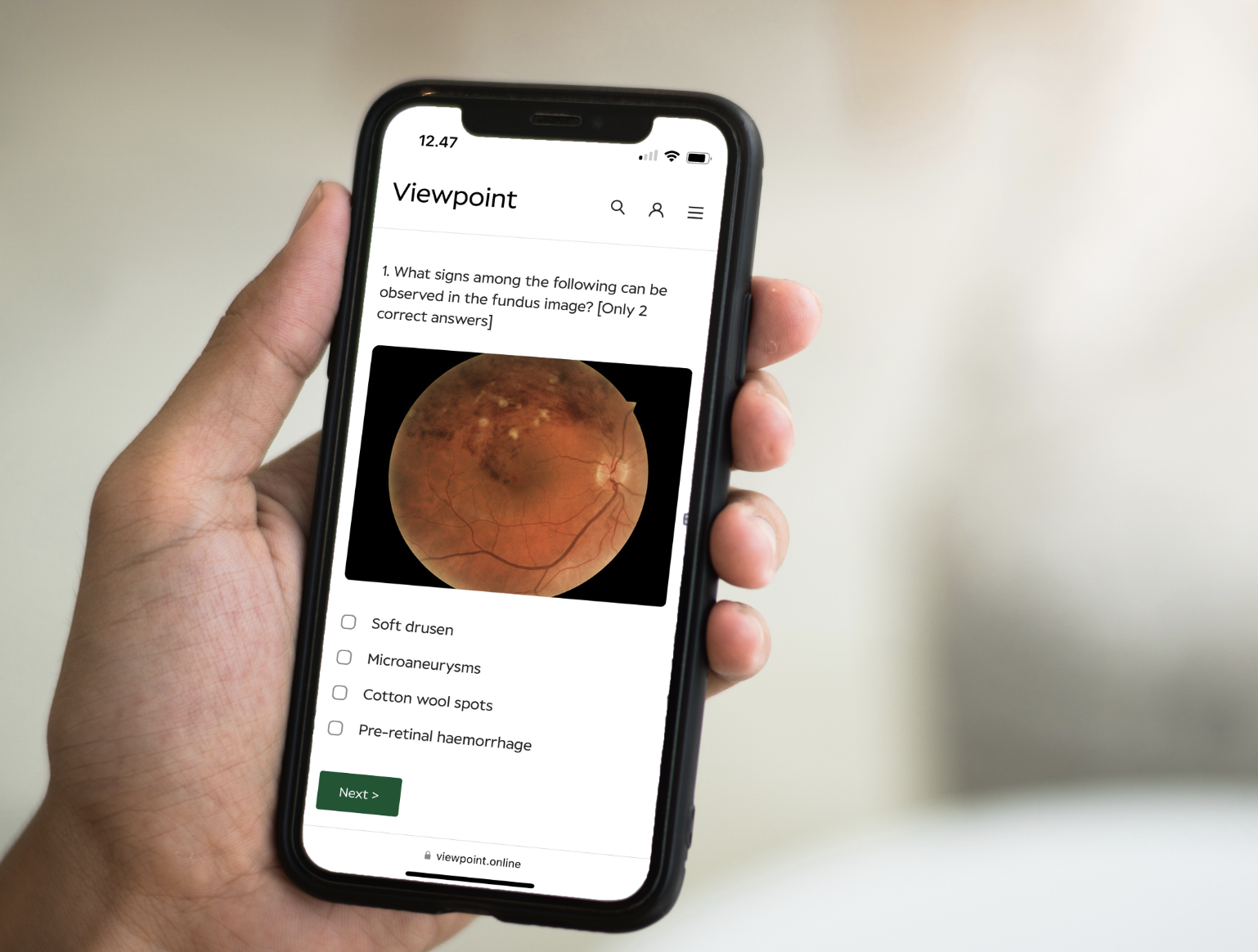 Case: Blurry vision | Viewpoint