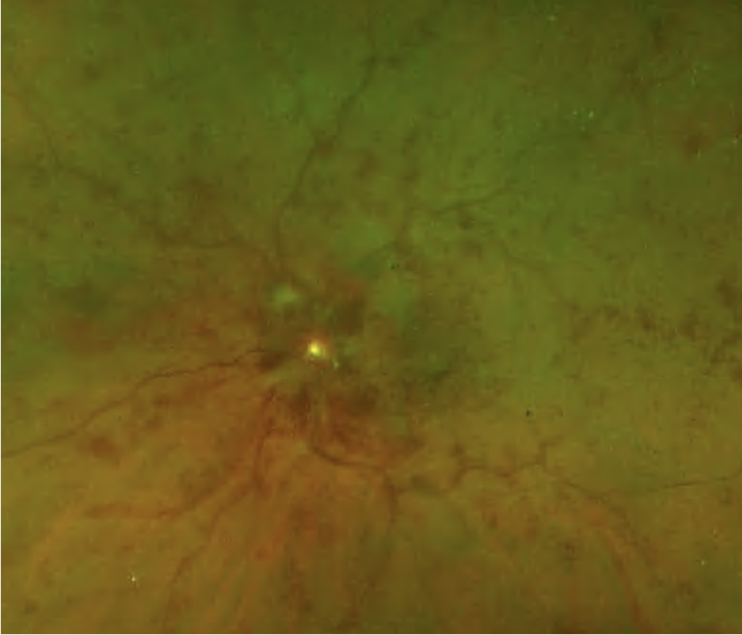 Viewpoint | Optometry e-learning content | viewpoint.online