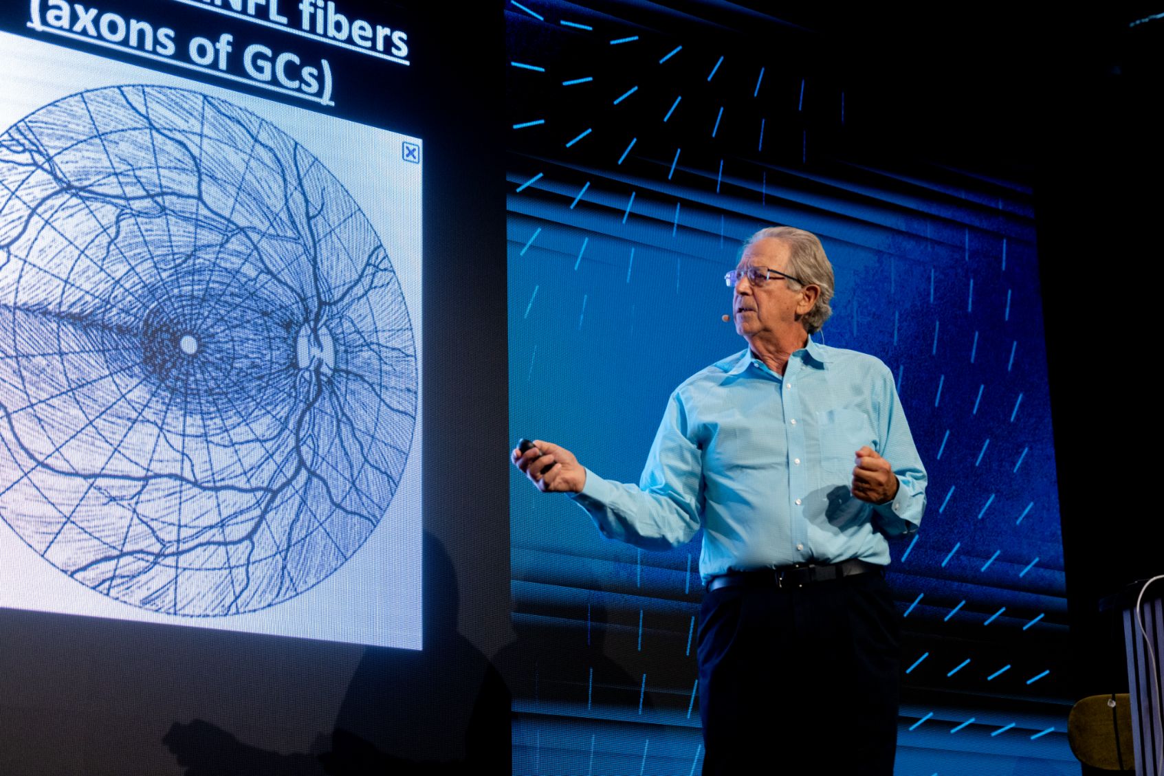 Primary and secondary open-angle glaucoma | Viewpoint